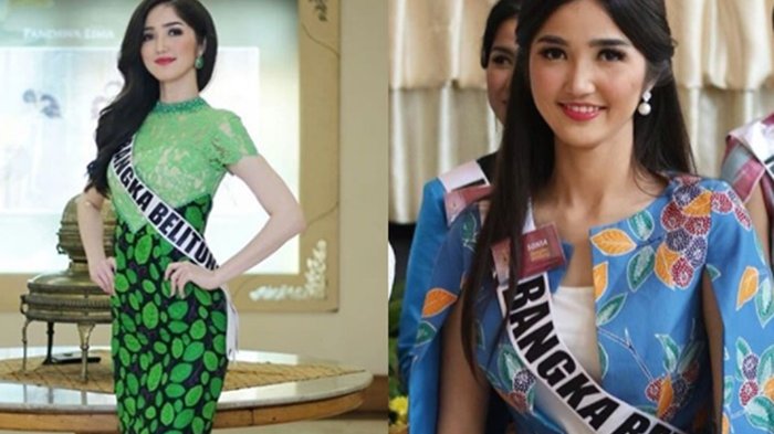 5 Fakta Menarik Tentang Sonia Fergina Citra, Pemenang Puteri Indonesia ...