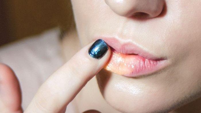 8 Tanda Kesehatan Dilihat dari Kondisi Bibir, Salah Satunya Bibir Pecah ...