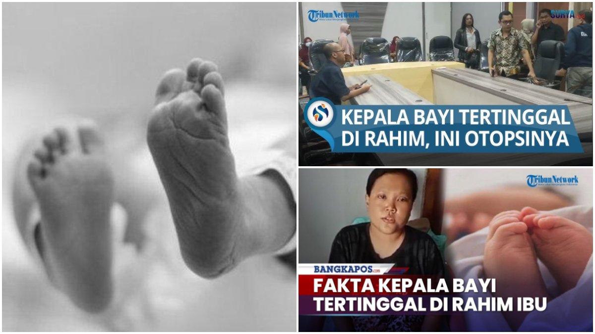 5 Fakta Termiris Kepala Bayi Tertinggal di Rahim Saat Lahir: Detik-detik Persalinan & Kata ...