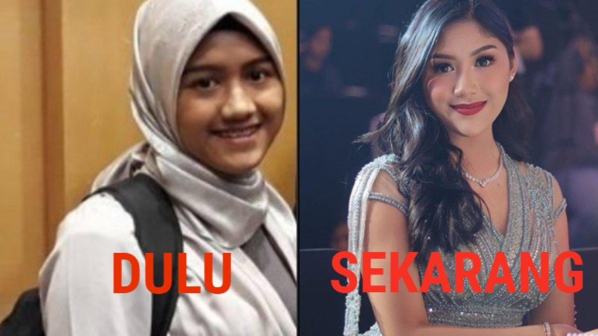 Beredar Foto Lawas Erina Gudono Kala Belum Glow Up, Istri Kaesang ...