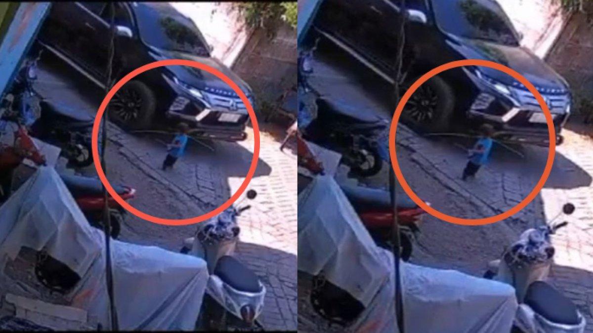 KRONOLOGI Pajero Lindas Balita di Makassar, Korban Pincang Paha Bengkak ...