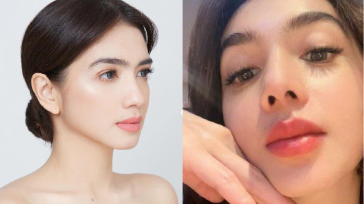 7 Potret Angel Karamoy Sebelum & Sesudah Oplas di Seoul Korsel, Hidung ...