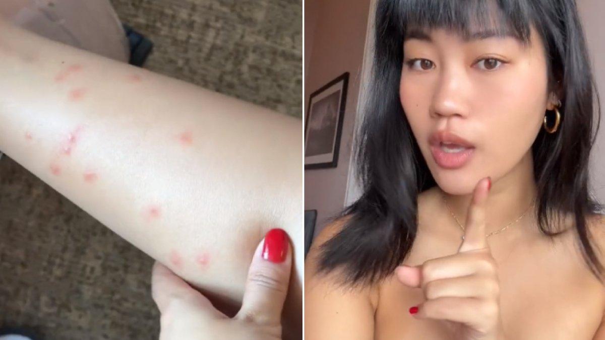 Wabah Kutu Busuk di Prancis Makin Parah, TikToker Ini Jadi Korban di Kereta: Gatal Seluruh Tubuh ...