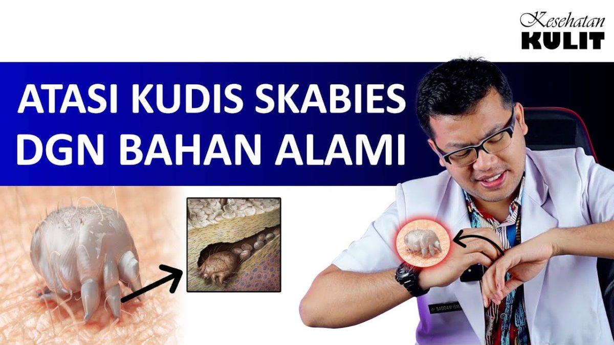 7 Cara Mudah Mengatasi Kudis Scabies Tanpa Harus Pergi ke Rumah Sakit ...