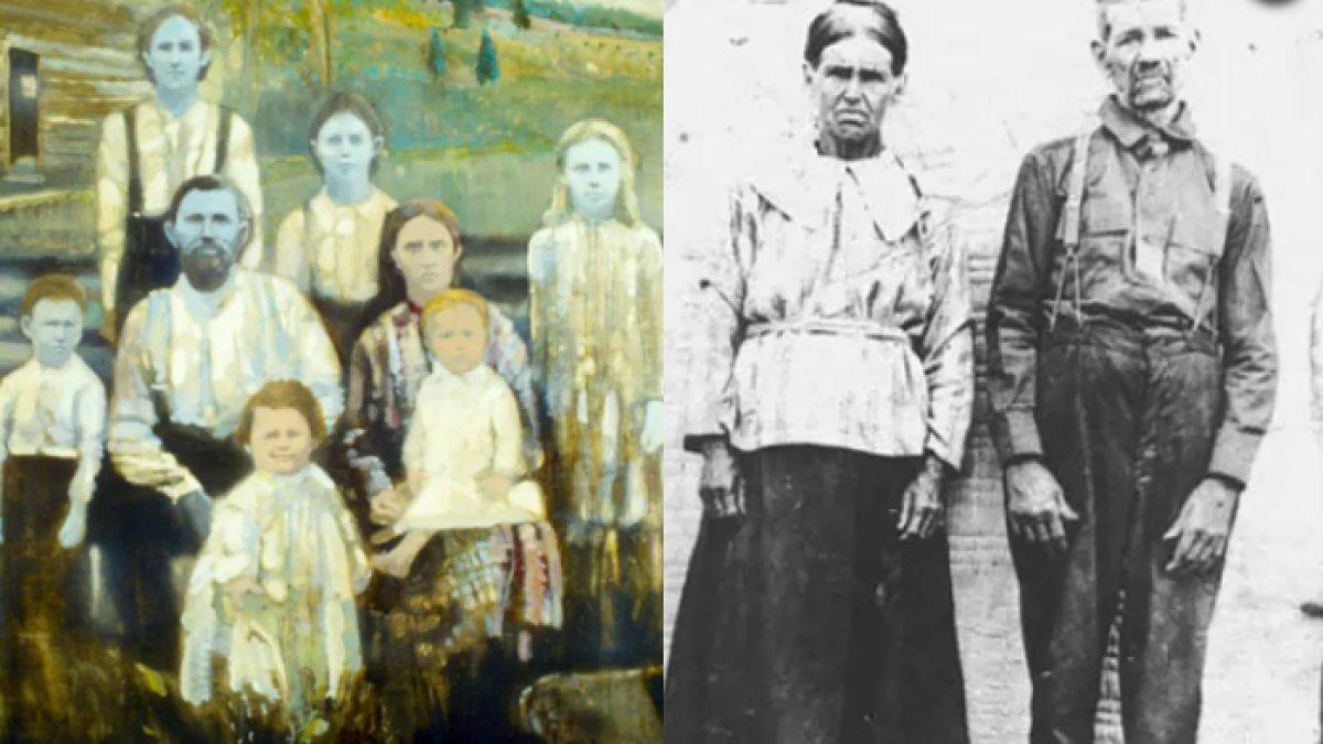 KISAH Keluarga Berkulit Biru, Ternyata Gegara Perkawinan Sedarah, bak ...