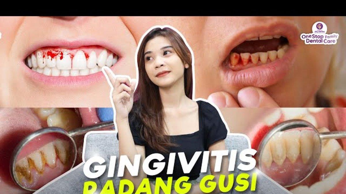 5 Cara Mudah yang Bisa Kalian Coba Untuk Menghentikan Radang Gusi ...