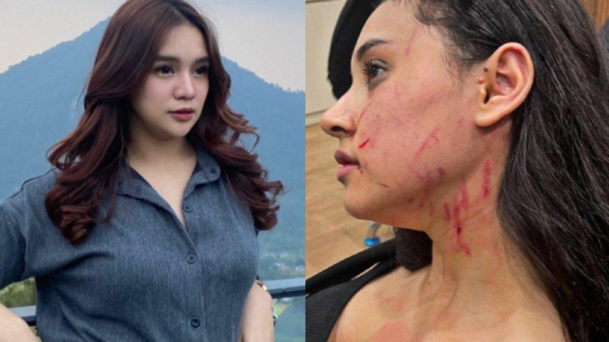 'Mungkin Dia Kaget' Regi Nazlah Muncul Klarifikasi Soal Aniaya Afifah Riyad, Sesumbar Dipukul ...