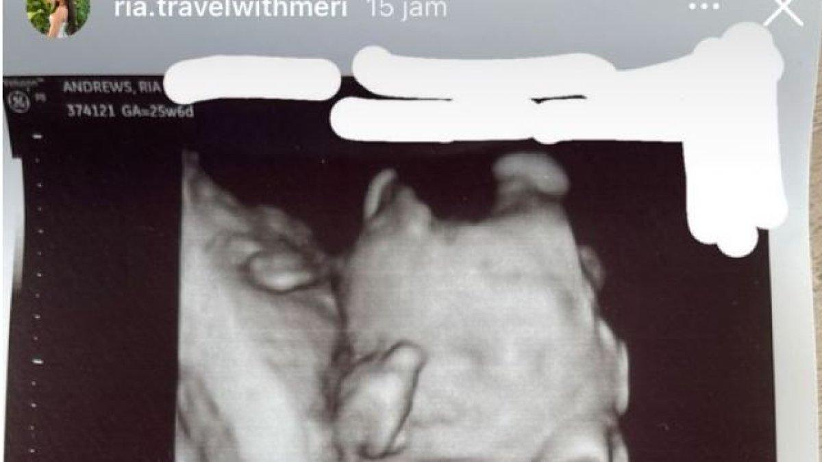 7 Momen Ria Andrews Hamil dan Lahirkan Anak Stefan William, Tak Pernah ...