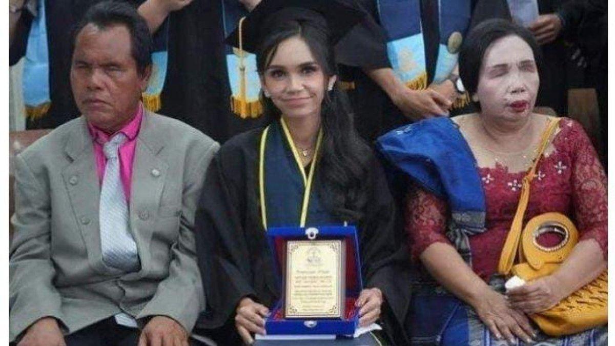Kisah Septiana, Anak Pasangan Tunanetra Jadi Wisudawan Terbaik ...