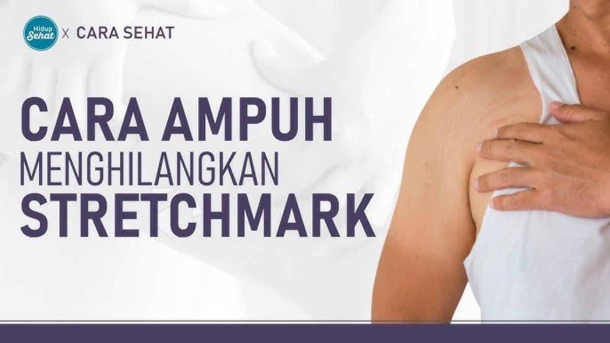 5 Cara Mudah dan Efektif Menghilangkan Stretch Mark dengan Cepat ...