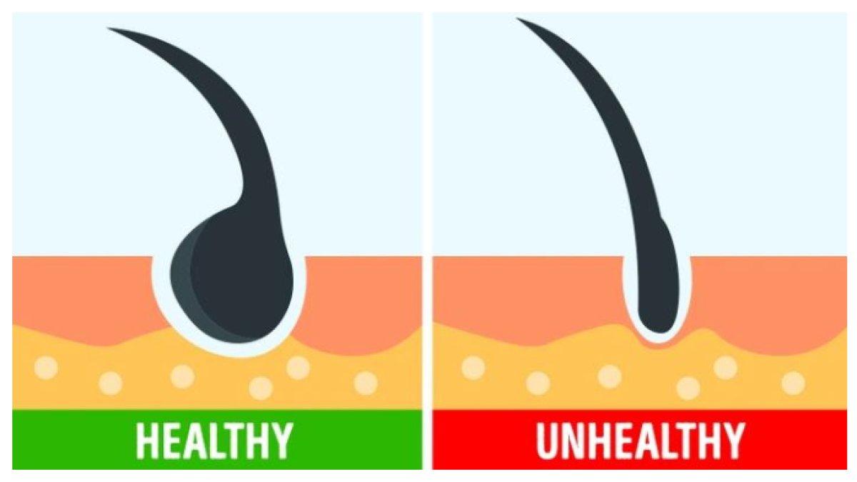 4 Cara Mengetahui Kesehatan Rambut Anda - TribunStyle.com