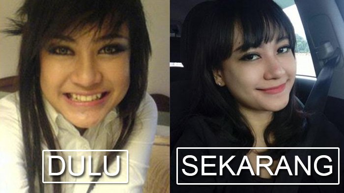 Masih Ingat AiU Ratna eks Vokalis Garasi? Dulu Metal, Sekarang Kawai ...