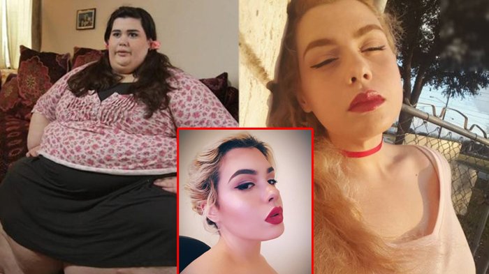Berbobot 299Kg, Cewek Ini Merasa Seperti Monster, tapi 2 Tahun Kemudian, Penampilannya Bikin ...