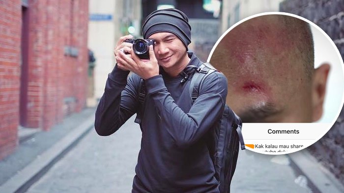 Kisahkan Kecelakaannya Tapi Dituduh Cari Viewers Oleh Netizen, Begini ...