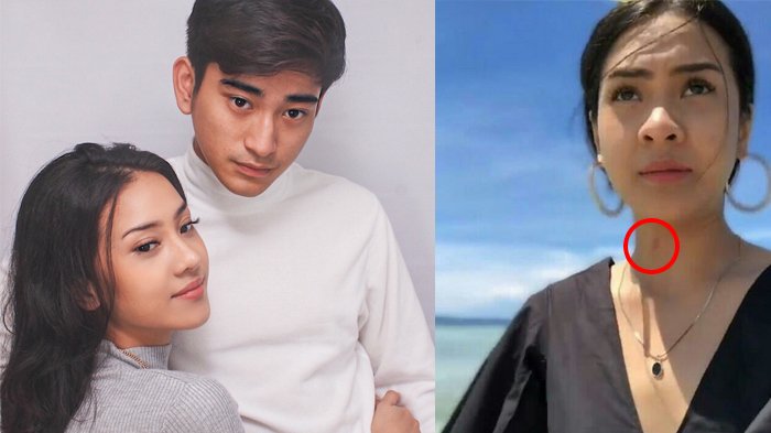Liburan Bareng Pacar Baru, Tanda Merah di Leher Anya Geraldine Bikin Salfok! - TribunStyle.com