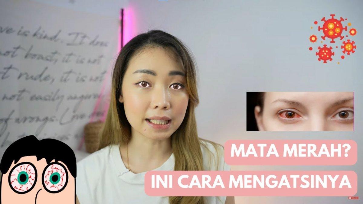 5 Cara Mudah dan Ampuh Mengatasi Mata Merah , Salah Satunya dengan Cara ...