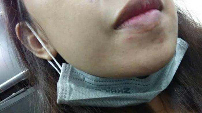 Jangan Dilakukan Lagi, Ternyata Ini Bahaya Kebiasaan Menurunkan Masker ...