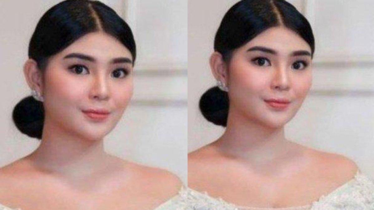 Cara Memutihkan & Samarkan Ketiak Hitam, Menggunakan Gula Pasir, Cerah ...