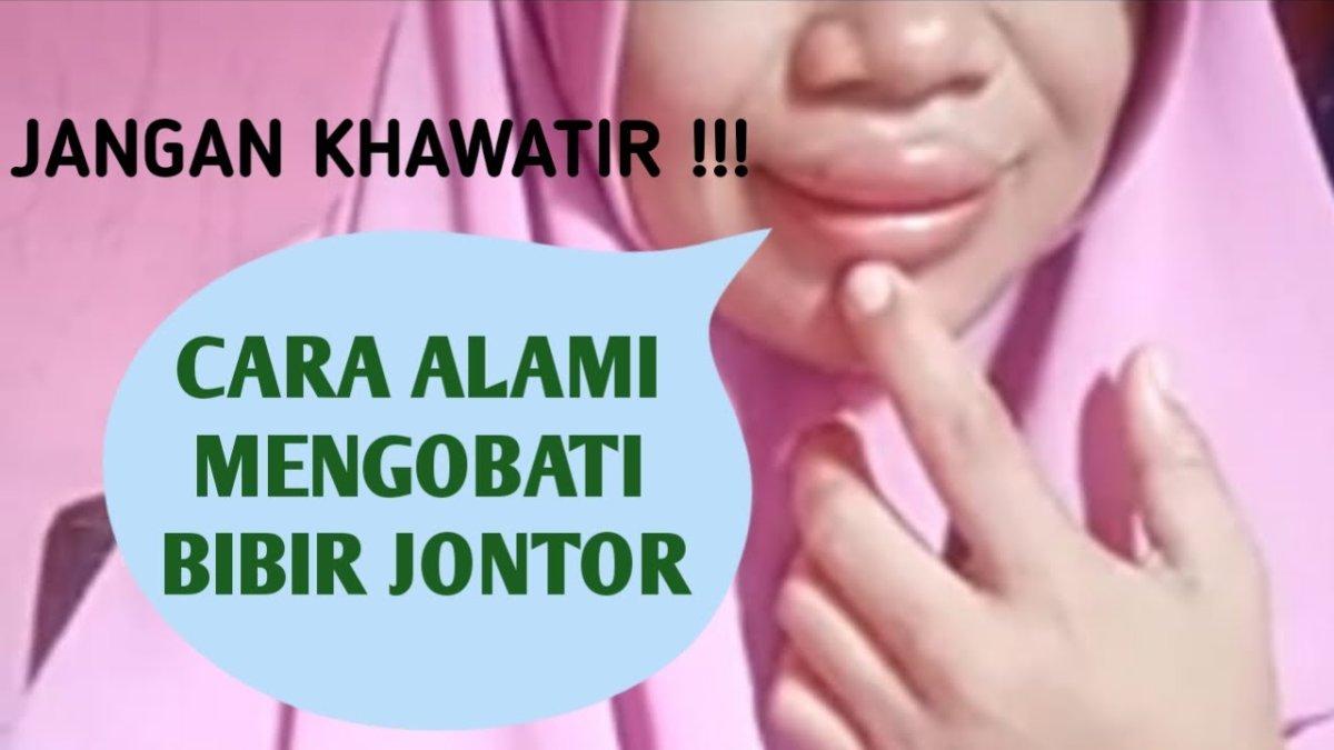 5 Cara Mengatasi Bibir Bengkak Digigit Semut Dengan Kompres, Berkumur ...