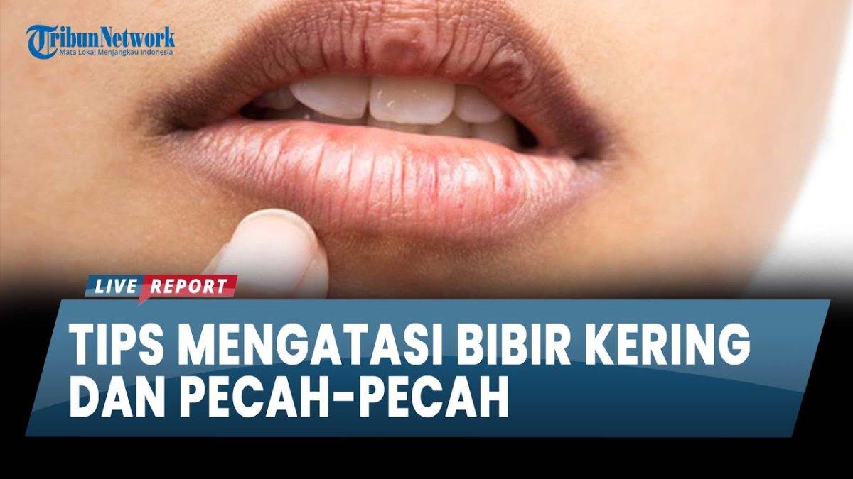 5 Cara Mengatasi Bibir Mengelupas Dengan Minum Air Putih, Gula, Dijamin ...