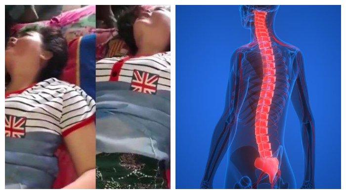 Candaan Geser Kursi, Gadis SMA Pamekasan Patah Tulang Belakangnya, Bisa Lumpuh, Simak ...