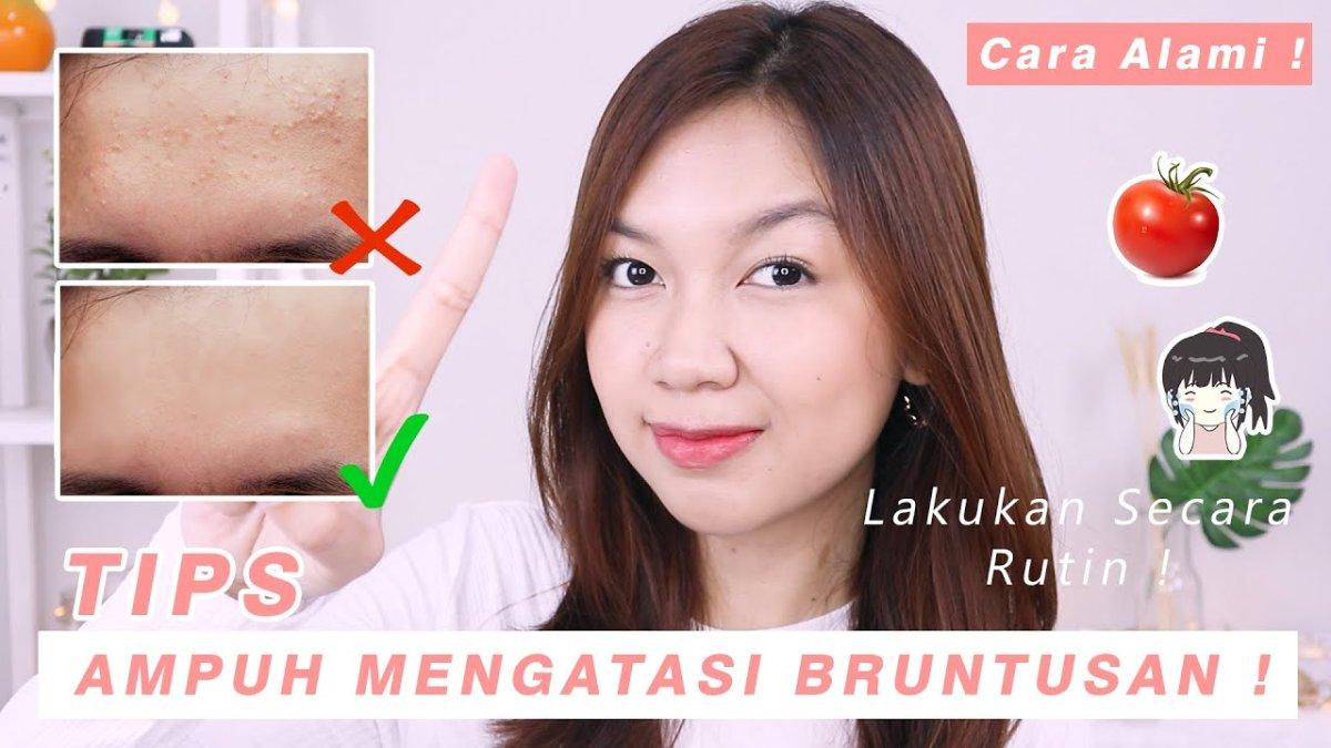 5 Cara Mudah Menyembuhkan Kulit Bruntusan dengan Cepat, Penyembuhan Secara Mandiri - TribunStyle.com