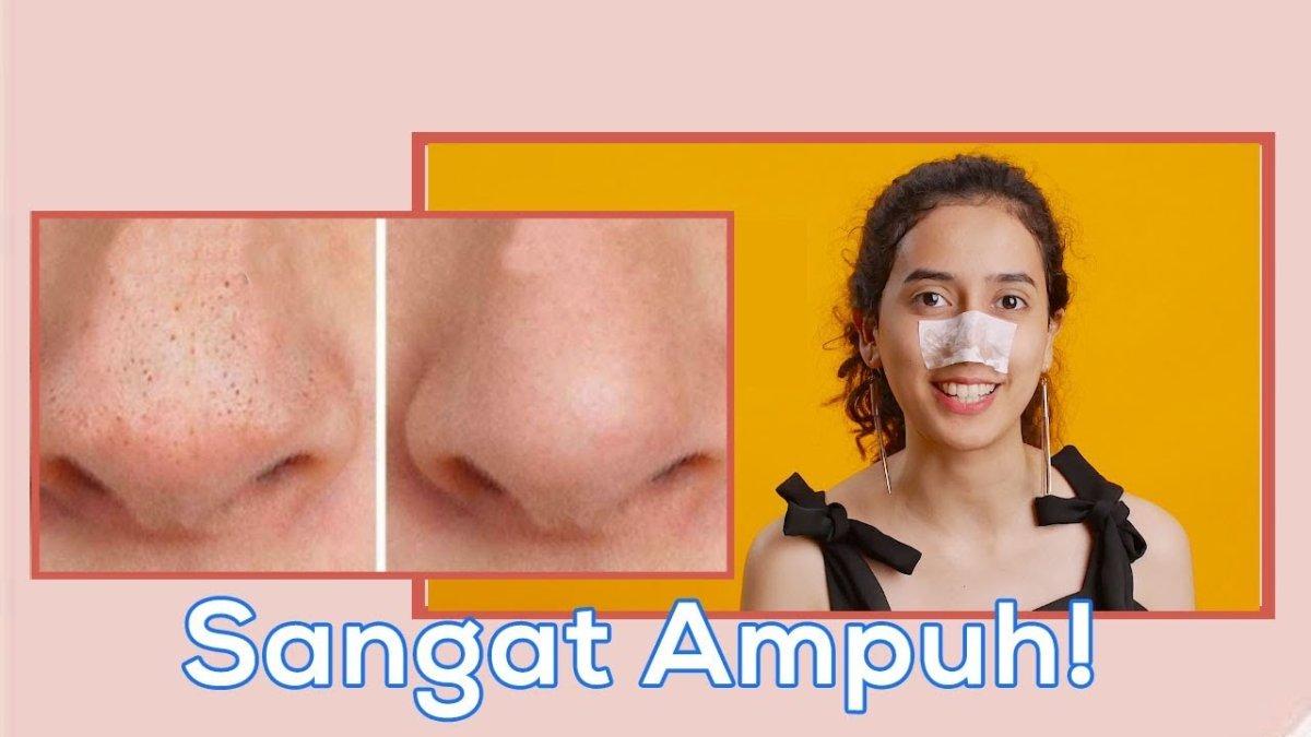 5 Cara Mudah Menghilangkan Komedo yang Membandel, Bikin Wajah Terlihat ...