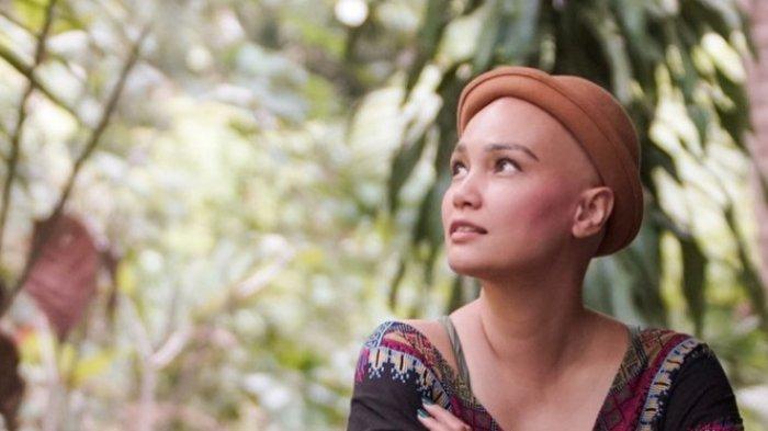 Hari Kanker Sedunia, Intip Kilas Balik Perjuangan Feby Febiola Berhasil ...
