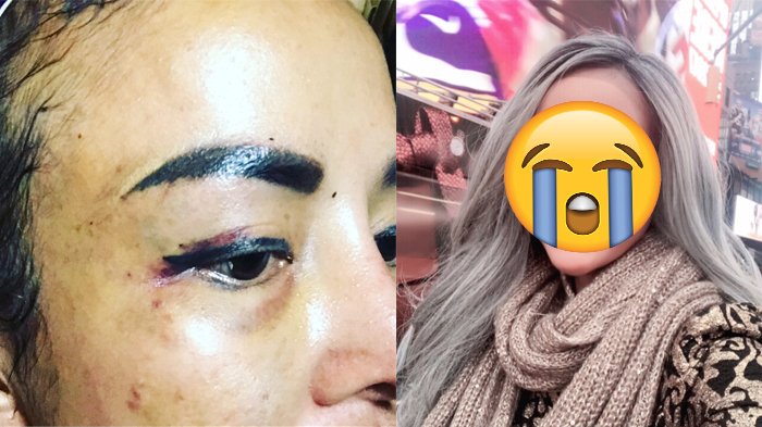 Lama Tak Muncul di Layar Kaca, Model Ini Tiba-tiba Unggah Foto Wajah Penuh Luka dan Lebam ...