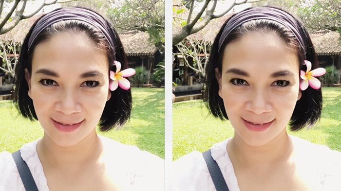 5 Potret Dian Nitami Setelah Sebulan Oplas, Makin Cantik dan Awet Muda ...