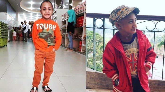 INNALILLAHI, Pemain Sinetron Dicky Topan 'Si Entong' Tutup Usia di Umur ...