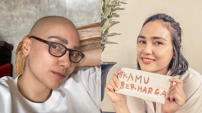 Profil dan Medsos Feby Febiola, Usai Sembuh Dari Kanker Ovarium, Begini ...