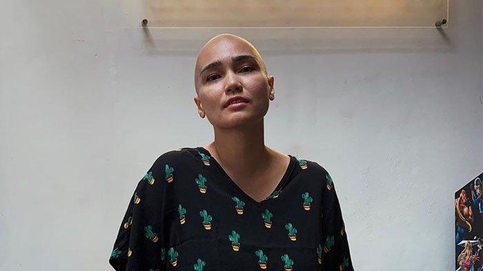 Profil dan Medsos Feby Febiola, Usai Sembuh Dari Kanker Ovarium, Begini ...