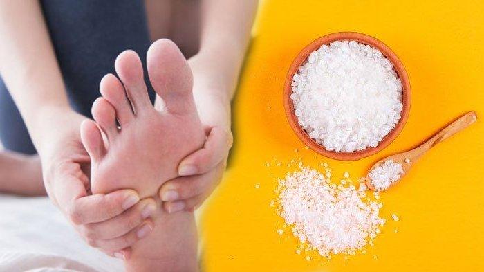 5 Cara Mengobati Kutu Air dengan Bahan Rumahan, Singkirkan Gatal Pakai ...