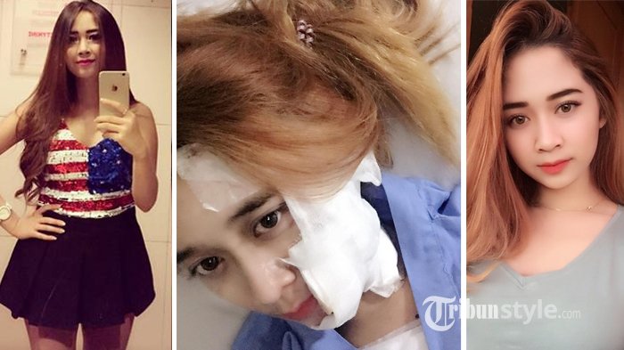 Intan Novita Instagram - Masih Ingat Wanita Disiram Air Keras, Begini ...