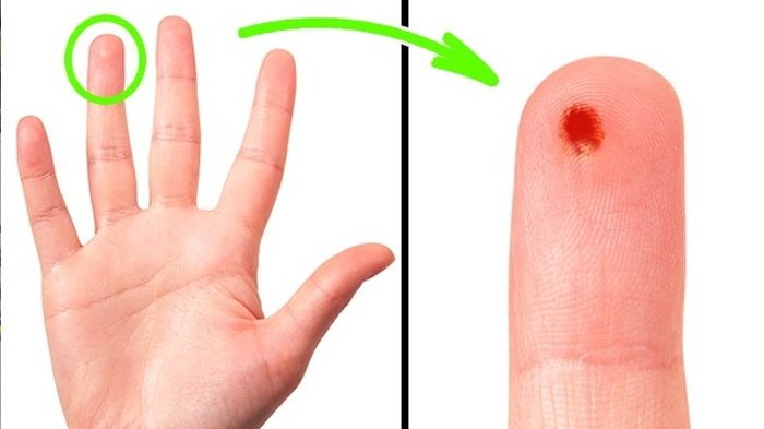 Jarang Diketahui, Ternyata Ini Alasan Pemilihan Jari Manis untuk ...