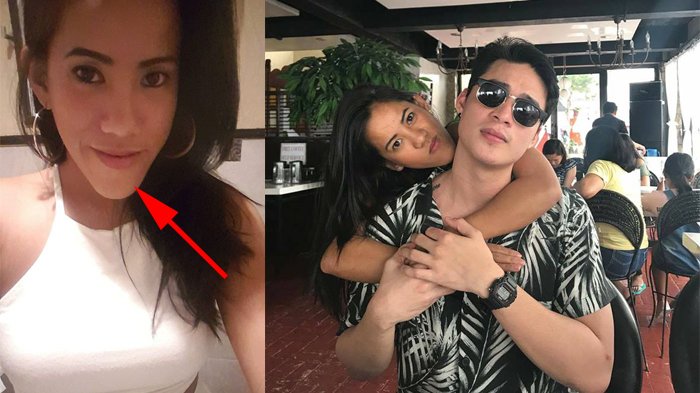 Wanita Berdagu Panjang Sering Jadi Lelucon, tapi Netizen Kaget Saat Ia ...