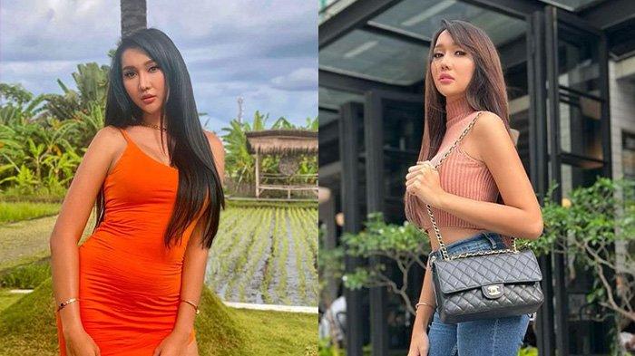Lucinta Luna Kembali Jalani Operasi Plastik, Kepala Penuh Perban, Ivan ...