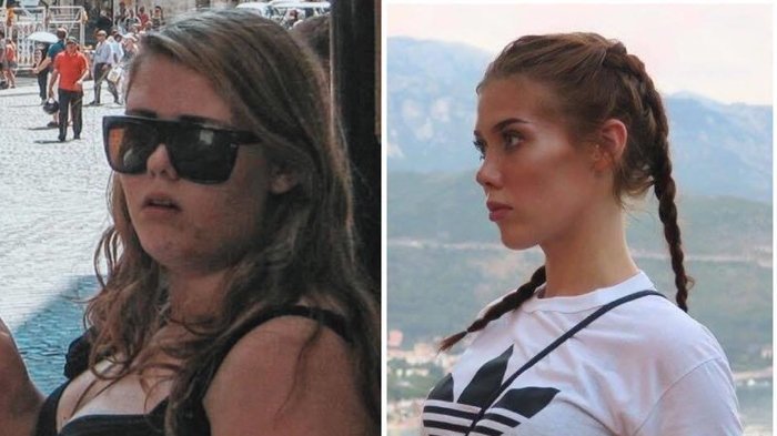 Mahasiswi Obesitas Ini Turunkan Berat Badan dengan Sendok Teh, Sekarang ...