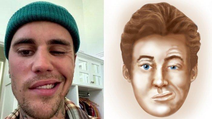 Mengenal Sindrom Ramsay Hunt, Kelumpuhan Wajah yang Dialami Justin ...