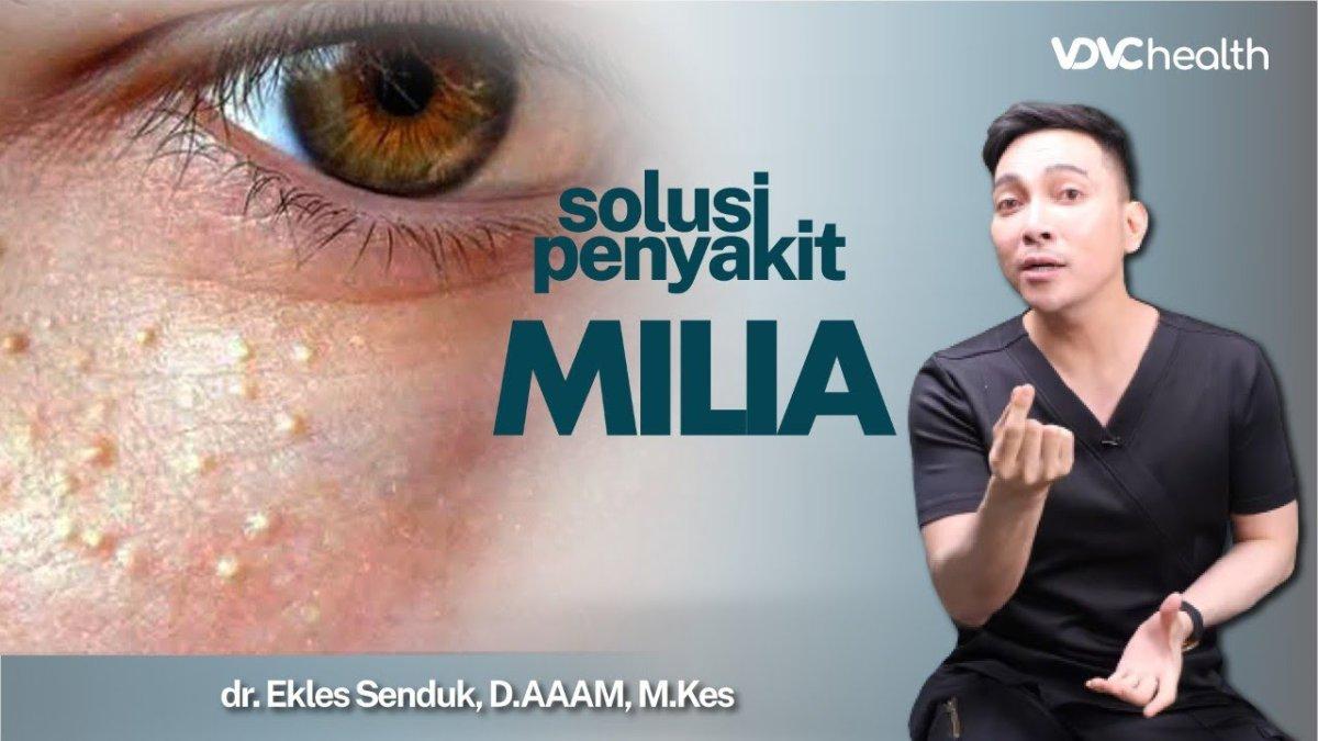 5 Cara Cepat dan Mudah yang Bisa Kalian Coba Untuk Atasi Milia Tanpa ...