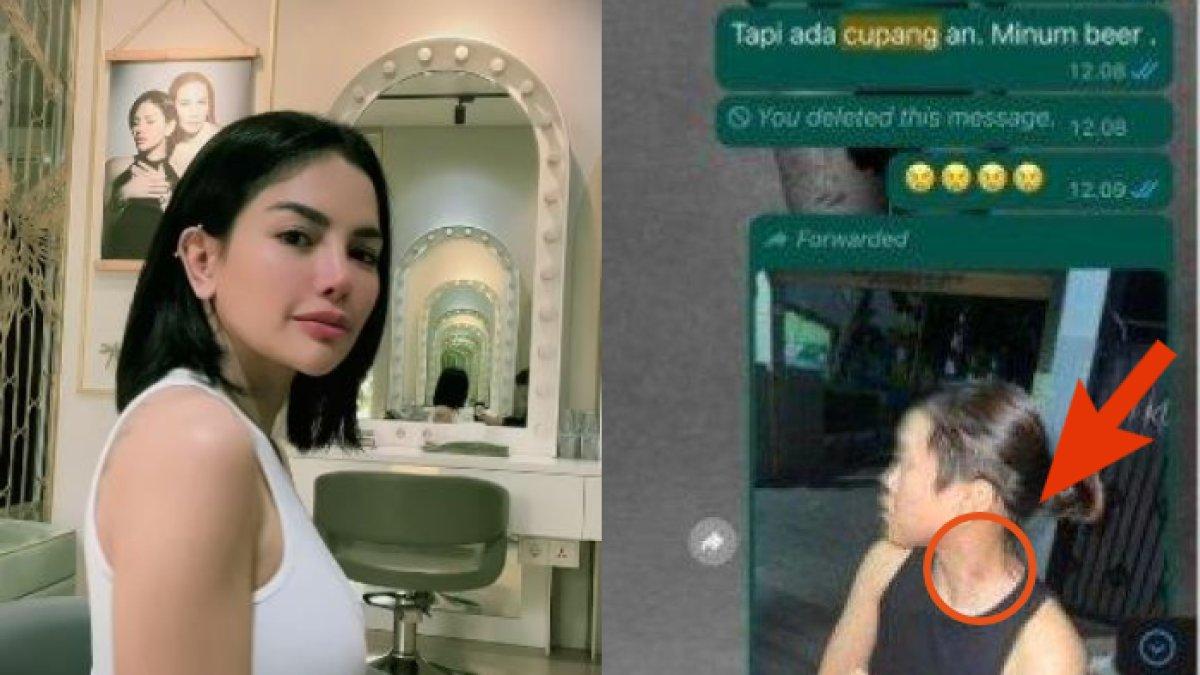 TERLANJUR! Nikita Mirzani Gencar Umbar Kenakalan Lolly, Bahas Bekas Cupang Leher: Masih Ingat ...