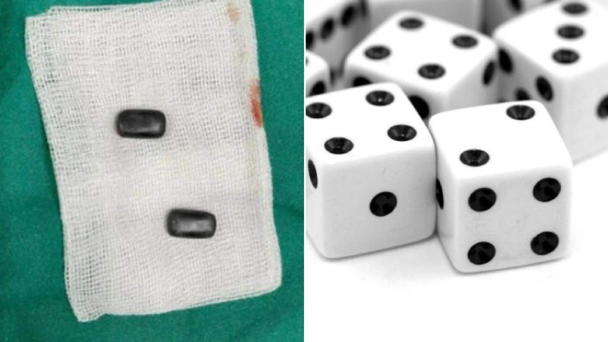 Demi Menang Judi Dadu, Pria Tanam Magnet di Jarinya Biar Bisa Curang ...