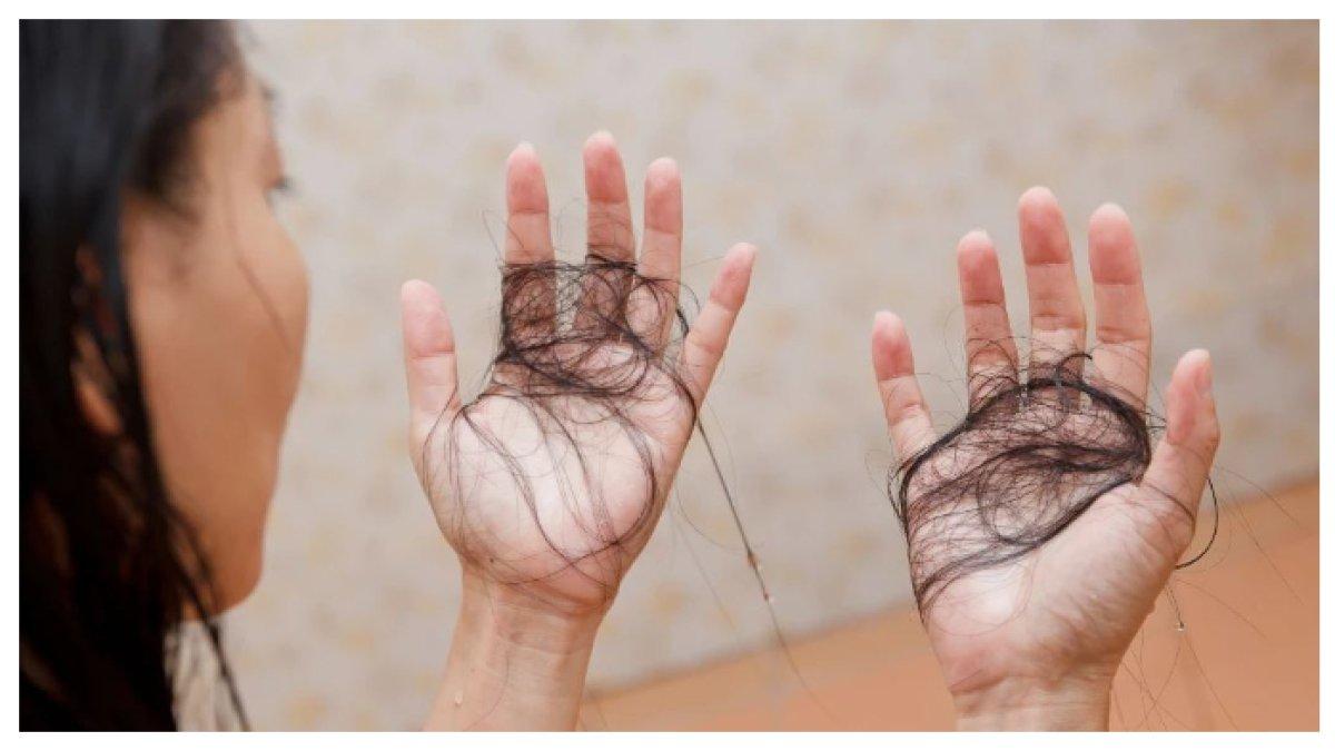 Kenapa Rambut Saya Rontok? Ini 9 Penyebab & Tips Mengatasinya ...