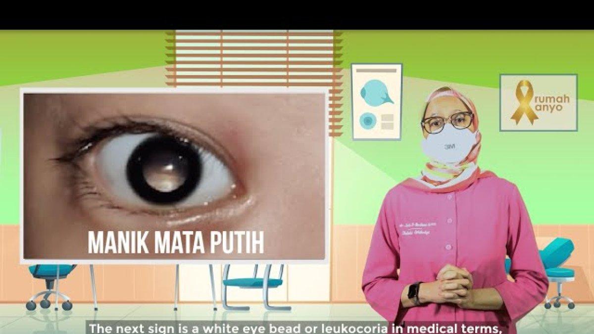 5 Cara Mengobati Retinoblastoma Pada Anak Dengan Operasi, Kemoterapi ...