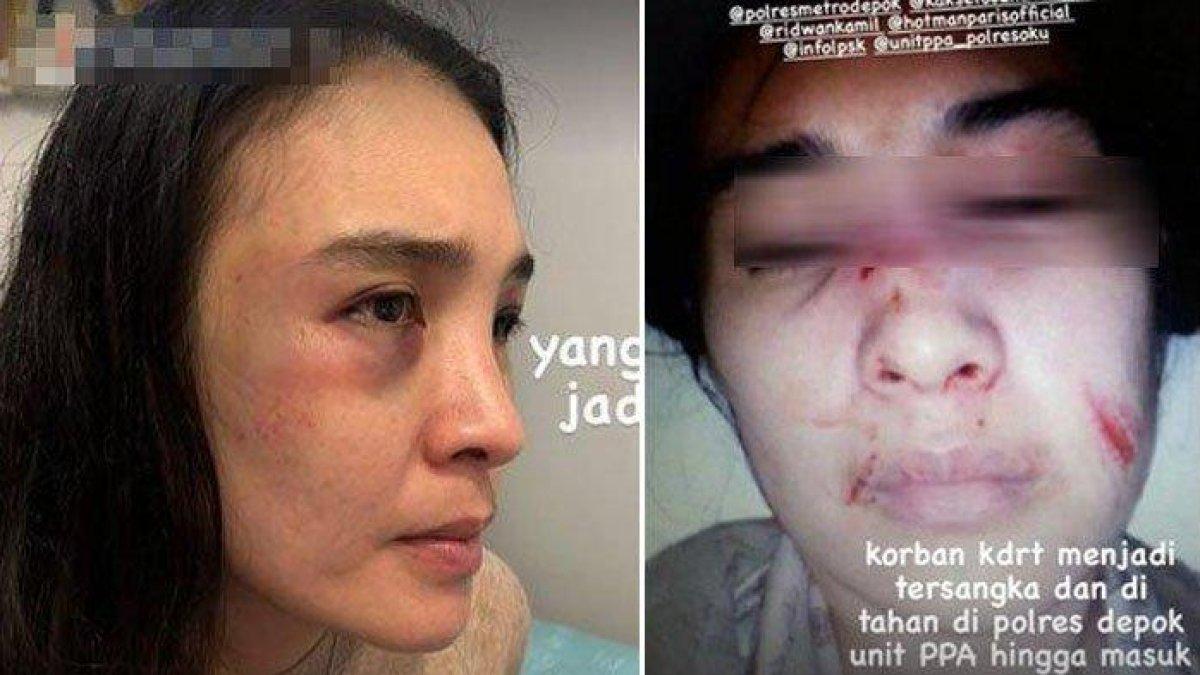 Niatnya Bela Diri, Istri di Depok Remas Alat Vital Suami Usai Disiram Bon Cabe, Sedih Jadi ...