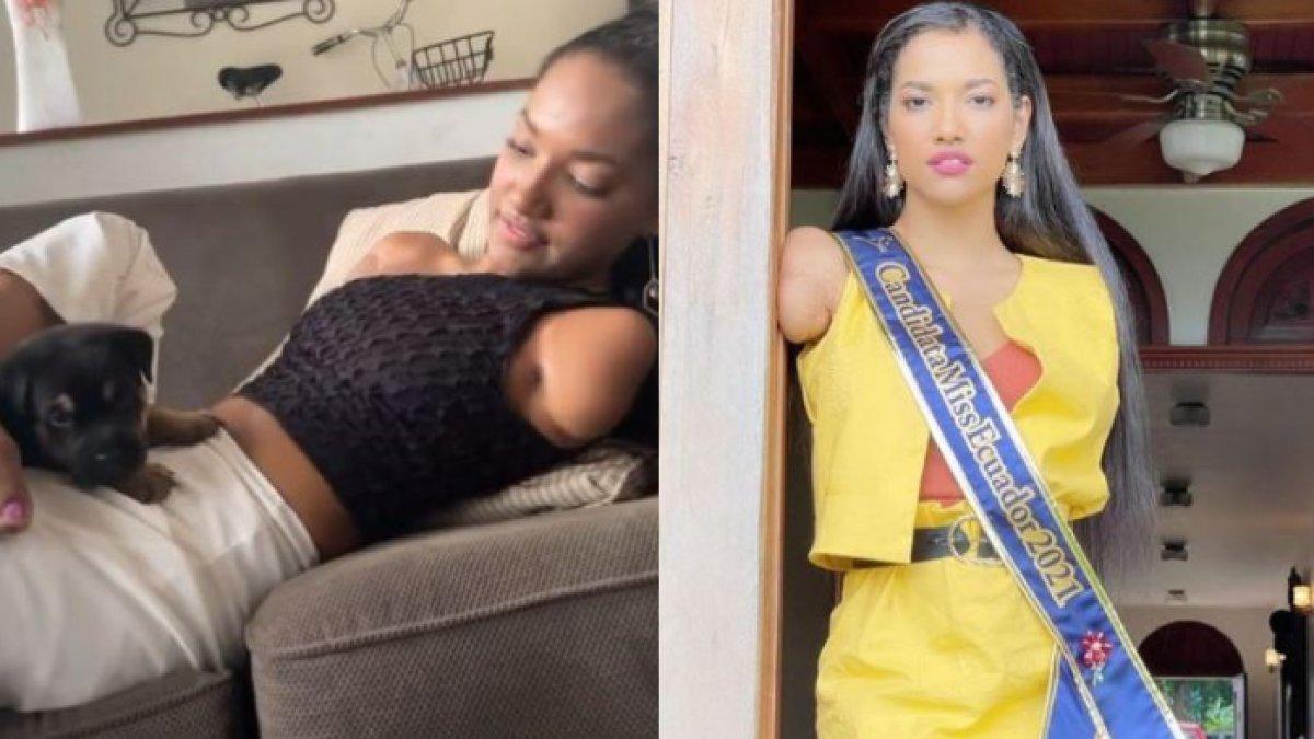 2 Tangan dan 1 Kakinya Diamputasi Sejak Kecil, Gadis Ini Kini Sukses Jadi Model: Ingin ...