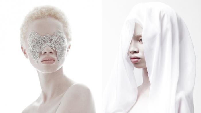 Setelah Ramai Khoudia Diop, Muncul Thando Hopa Model Albino yang ...