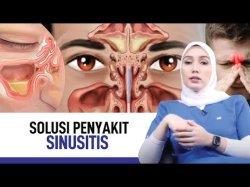 5 Cara Mudah dan Efektif Mengatasi Sinus Supaya Cepat Sembuh ...