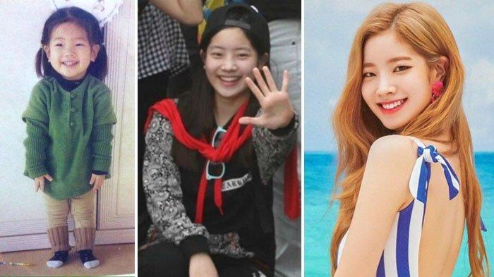 Dahyun TWICE Ulang Tahun ke-22, Ini Foto-foto Transformasinya dari Masa Kecil hingga Jadi ...